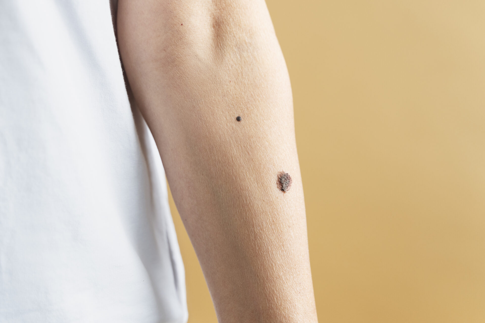 10 Common Skin Surgery Myths and The Truth Behind Them – Dermatology